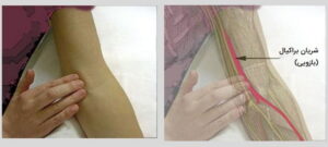 نحوه گرفتن فشار خون — آموزش تصویری و کامل – فرادرس - مجله‌